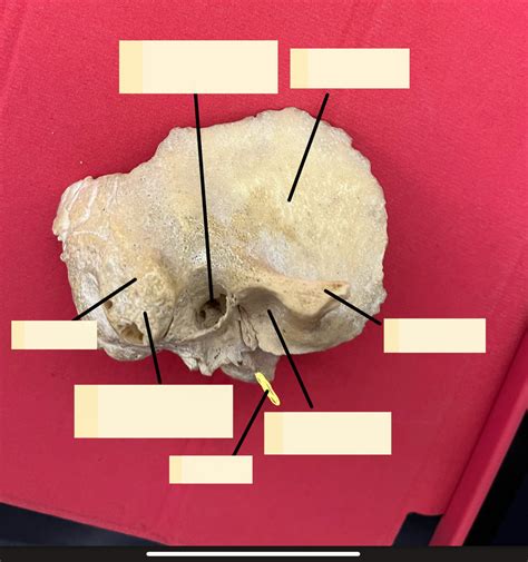 Temporal Bone Diagram Quizlet