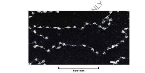 1 Electron Micrograph Of Chromatin Showing Its Structure That