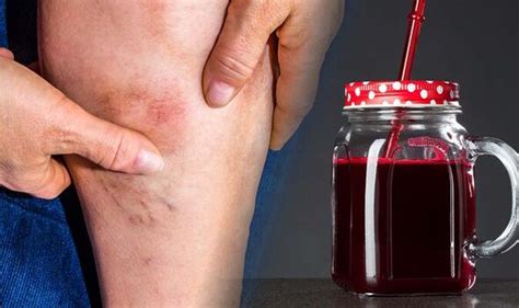 Luke Whelan Journalists Uk