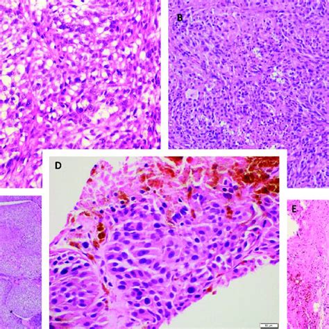These Are Mainly Examples Of Cytoplasmic Staining Properties A A Download Scientific