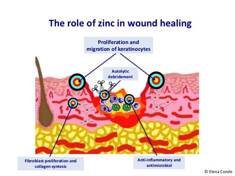 Zinc In Wound Healing Elena Conde