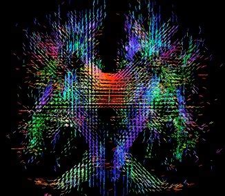 Diffusion Tensor Imaging 101 Diffusion Imaging Introduction Tutorials And Background On