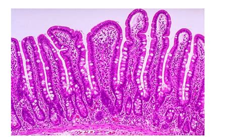 Crypts Of Lieberkuhn Diagram