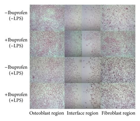 Microscopic Morphology Of The Osteoblast Interface And Fibroblast