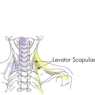 Sternocleidomastoid Insertion Trigger Point Region Download Scientific Diagram