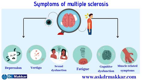 Multiple Sclerosisomeopathic Treatment Known As Ms Demylation Nerve Disease