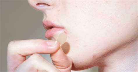 15 Best Pimple Patches Of 2025 Tested And Reviewed Nbc Select