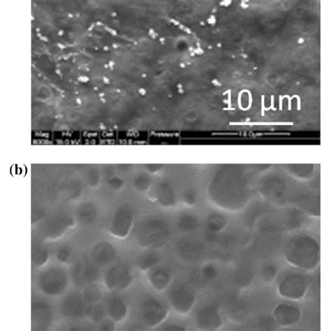 SEM Images Of BSA MBs With A 2 Mg DL DTT And B 5 Mg DL DTT Download Scientific Diagram