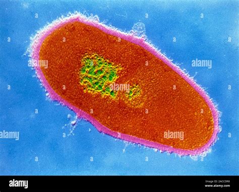 False Colour Transmission Electron Micrograph Tem Of Corynebacterium