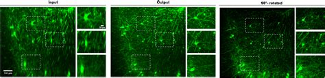 Figure 1 From Axial To Lateral Super Resolution For 3d Fluorescence