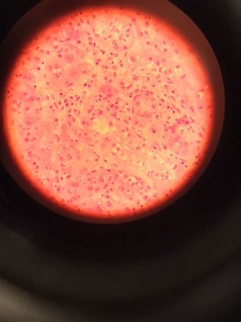 Stratified Epithelium Diagram Quizlet