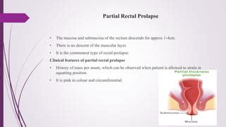 Rectal Prolapsepptx