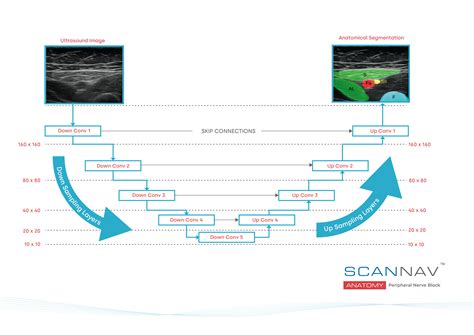 Artificial Intelligence For Ultrasound Scanning In Regional Anaesthesia Esra