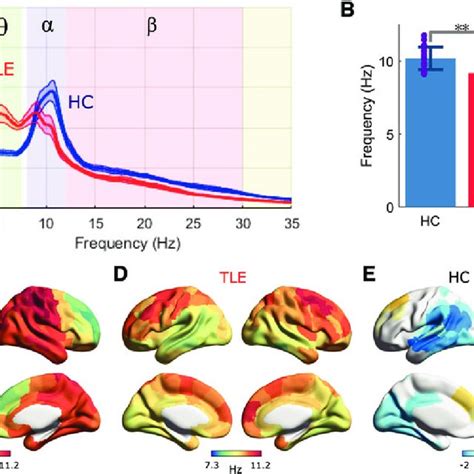 A Normalized Psds Of Source Timecourses Averaged Over The Whole Brain Download Scientific
