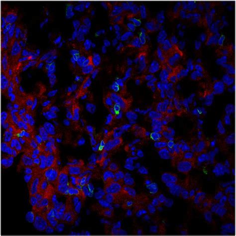 Immunofluorescence Image Of Th Image Eurekalert Science News Releases