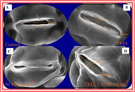 Scanning Electron Microscope Images Showing The Stomatal Behavior In M Download Scientific