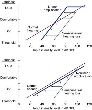 Hearing Aids Strategies Of Amplification Ento Key