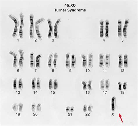 10 5 Fetal Growth And Development Medicine Libretexts