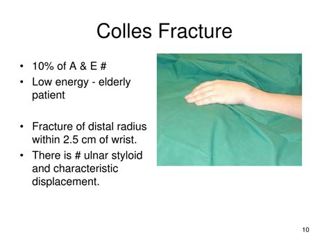 Ppt Common Fractures Powerpoint Presentation Free Download Id9700749