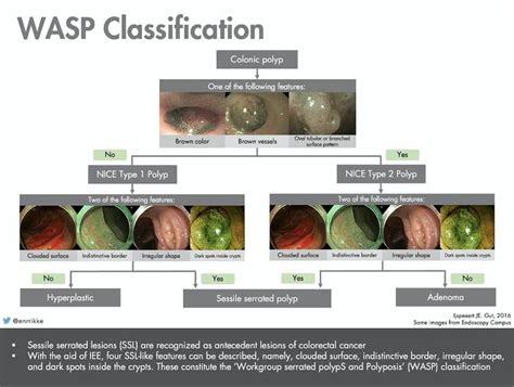 Klaus Mönkemüller On Linkedin Wasp Classification For Serrated Polyps Klaus Mönkemüller On Linkedin Wasp Classification For Serrated Polyps