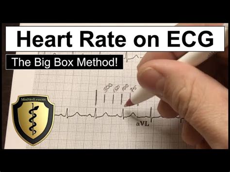 Check Mark Sign Ecg