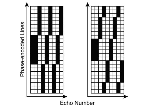 cartesian encoding scheme with a blocked undersampling pattern for