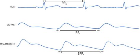 Figure 6 From A Photoplethysmography Smartphone Based Method For Heart Rate Variability