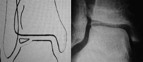 Fog Classification F Form Download Scientific Diagram