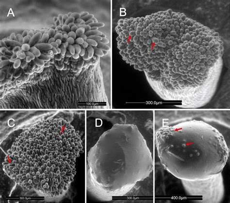 Ultrastructure Of Receptive Stigma And Transmitting Tissue At Anthesis