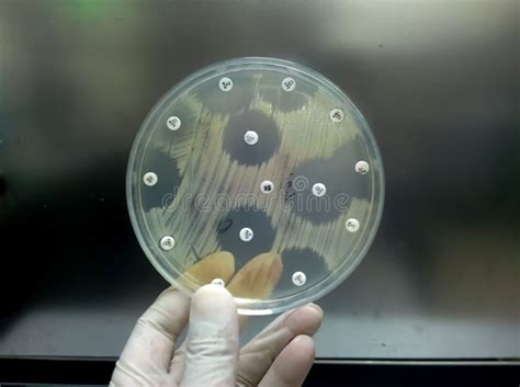 Antimicrobial Susceptibility Testing In Culture Plate Drug Sensitivity Test Antibiotic