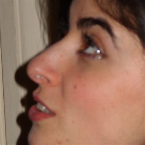 What If DAPI Staining Is Not Homogeneous Through The Section ResearchGate