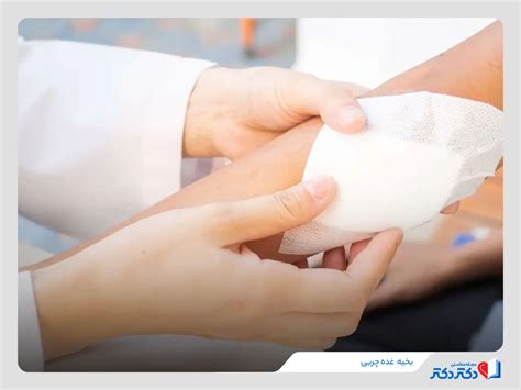 غده چربی چیست؟ راه‌های درمان پزشکی و خانگی صد در صد لیپوم