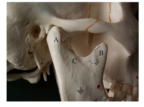 Mandiblemaxillaface Diagram Quizlet
