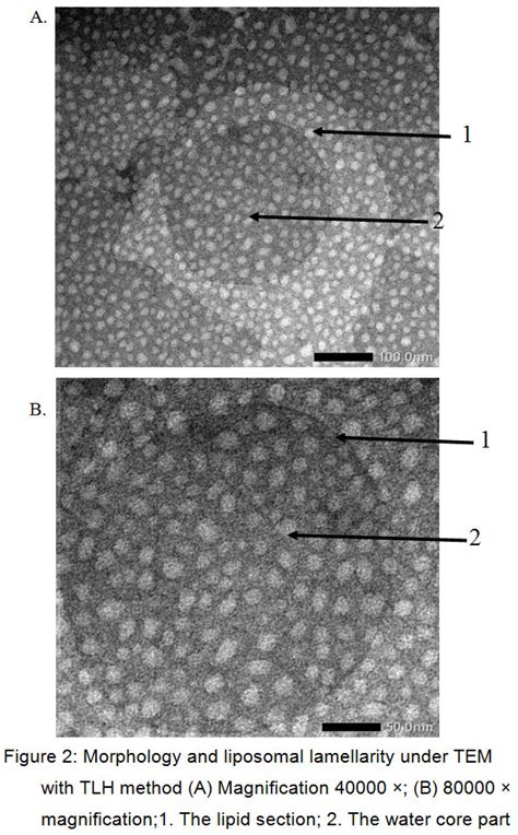 Formulation Of Liposome Using Sappan Wood Caesalpinia Sappan L Ethyl Acetate Fraction As An