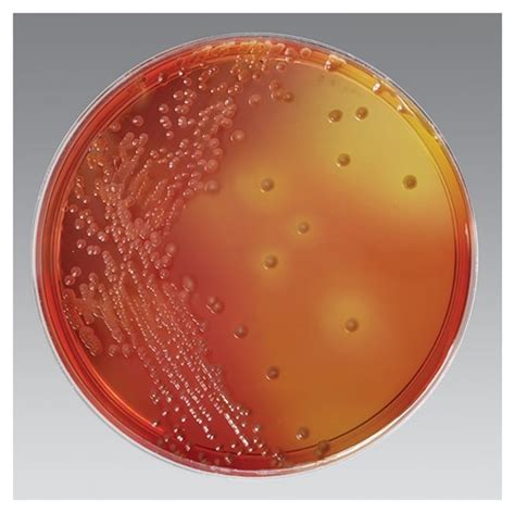Thermo Scientific Burkholderia Cepacia Selective Agar Buy Online