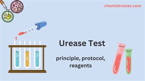 Urease Test Principle Protocol Results And Reliable Uses