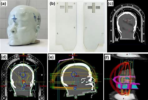 Suitability Of A Beo Based Osld System For End To End Remote Dosimetry