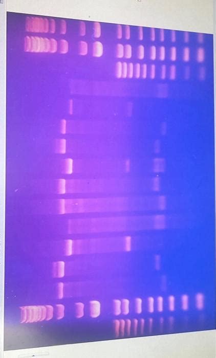 Solved What Is The Plasmid Dna Length When Determining