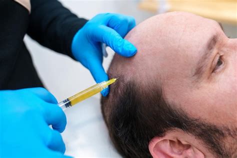 Premium Photo A Clinician Administers Prp Injection To Patients Scalp