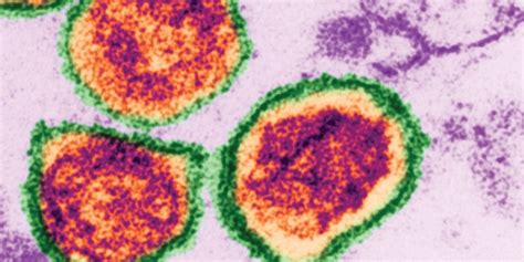 Hiv Virus Under Microscope