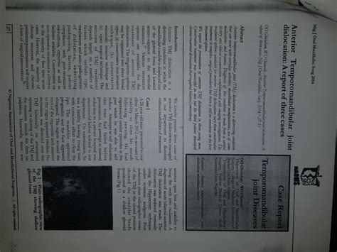 Pdf Anterior Temporomandibular Joint Dislocation A Report Of Three Cases