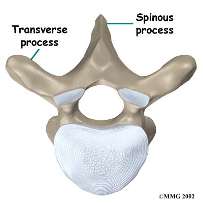 Transverse Process Lumbar