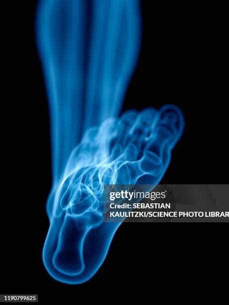Normal Bones Photos And Premium High Res Pictures Getty Images