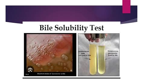 Streptococcus Pneumoniae Streptococcus Slideshare Pptx