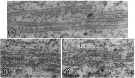 Electron Opaque Projections From Microtubules Of Treated Cells Download Scientific Diagram