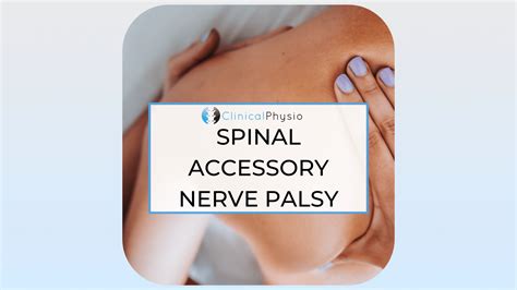 Spinal Accessory Nerve Palsy Clinical Physio Membership Spinal Accessory Nerve Palsy Clinical Physio Membership