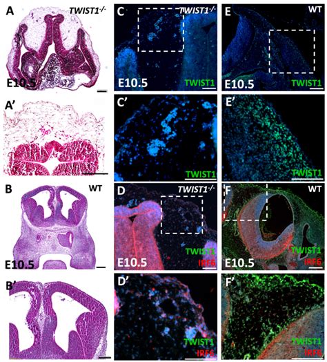 Fig S2 Validation Of Anti Twist1 Antibodies In Twist1 Null Embryonic Download Scientific