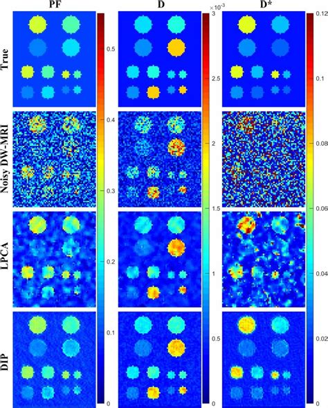 Parametric Maps Of Pf D And D Columns Obtained From Noisy Dw Mri Download Scientific