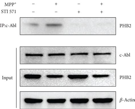 Phb2 As A Major Substrate Of C Abl In Pd Cell Model A Lc3iilc3i And