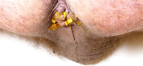 Porcine Rotund Behemoth Filthy Messy Asshole Winking ThisVid Com